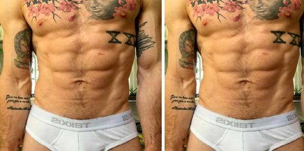 New Heat Activated Penis Implant Treats Erectile Dysfunction Yourtango